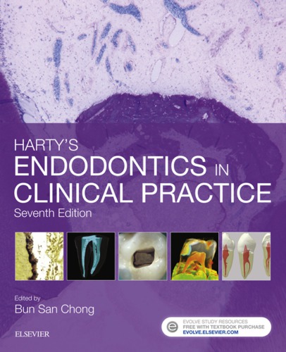Ebook – Harty’s Endodontics in Clinical Practice. (PDF Instant Download) – Library Store