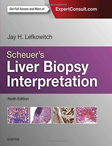Ebook – Scheuer’s Liver Biopsy Interpretation, 9e (PDF Instant Download) – Library Store